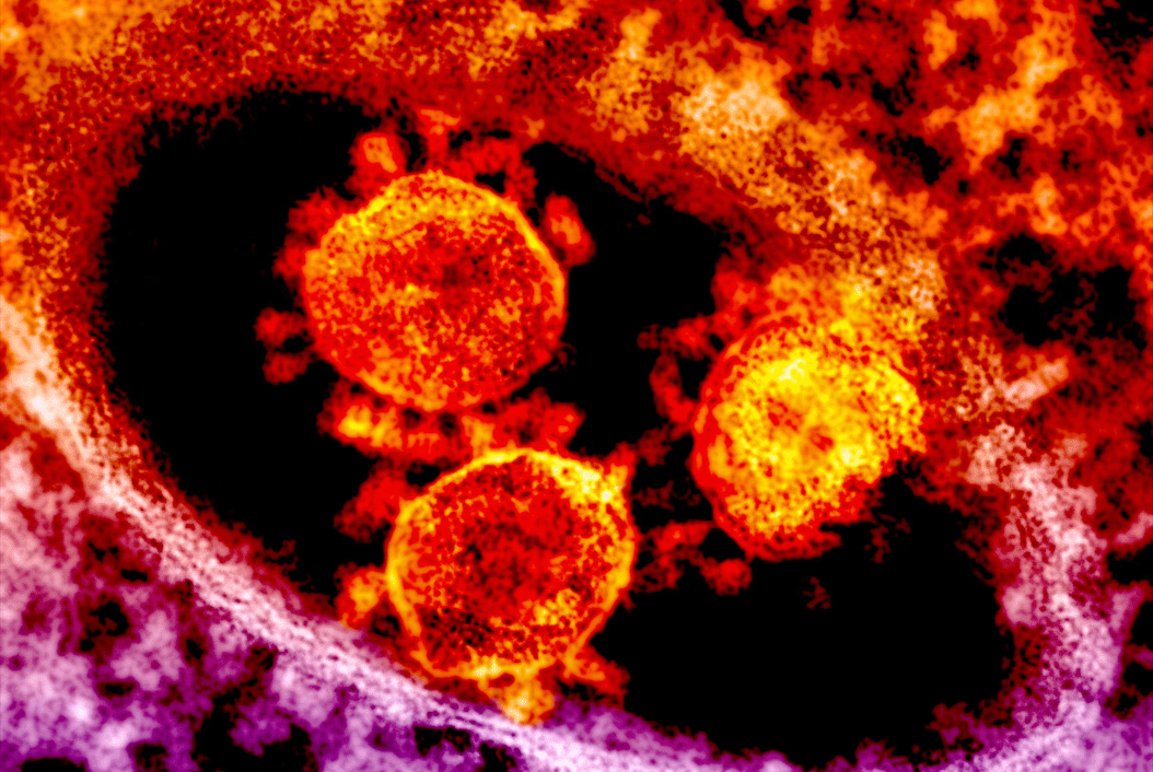 Samo nam je još to trebalo: Pronađen drevni virus star 15 tisuća godina ...